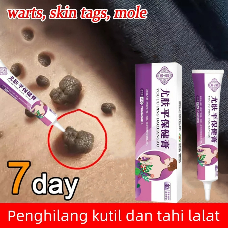 Jual [100% Original] Obat kutil penghilang kutil dan tahi lalat ...