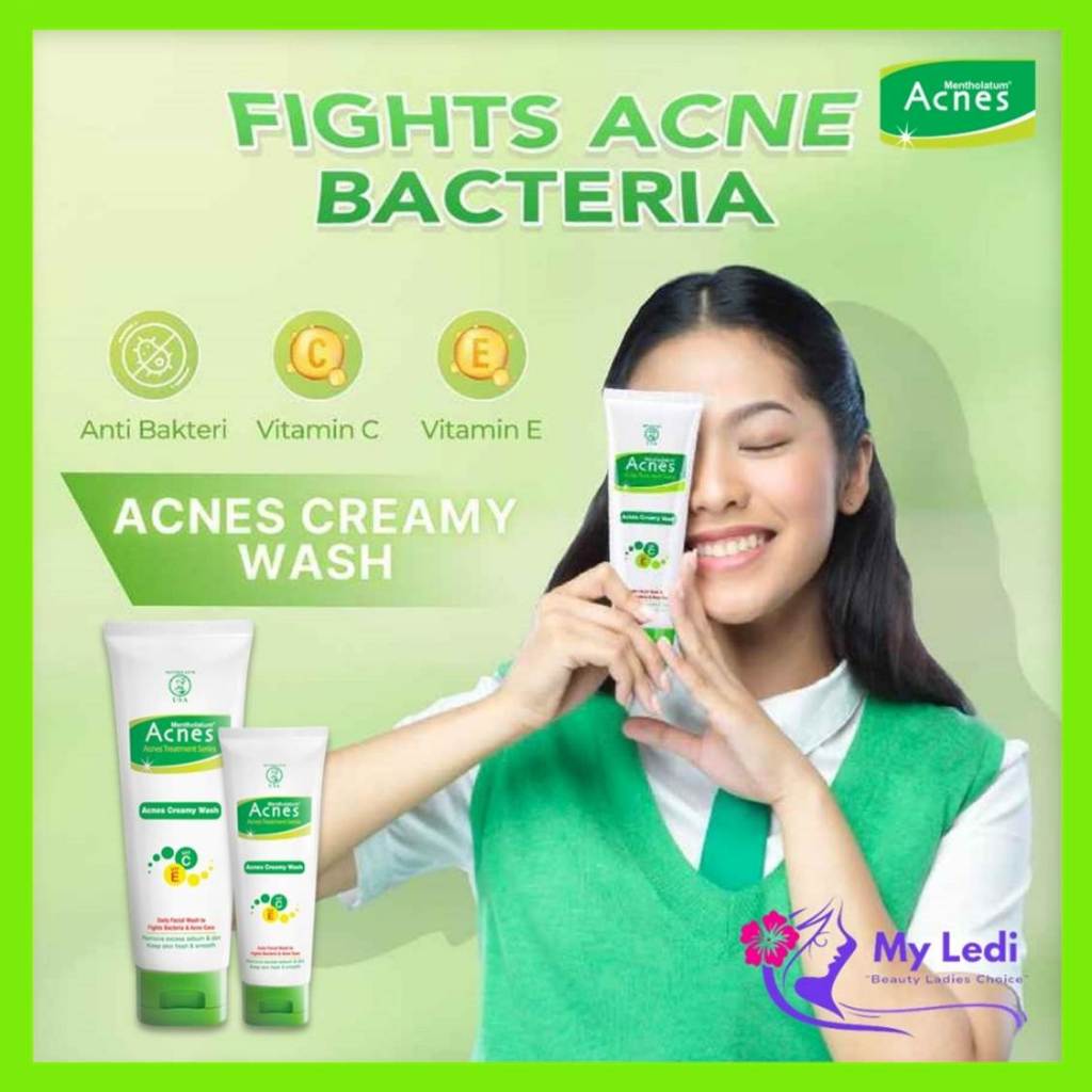 Jual Acnes Creamy Wash 100gr | Sabun Cuci Muka untuk Jerawat | Anti ...