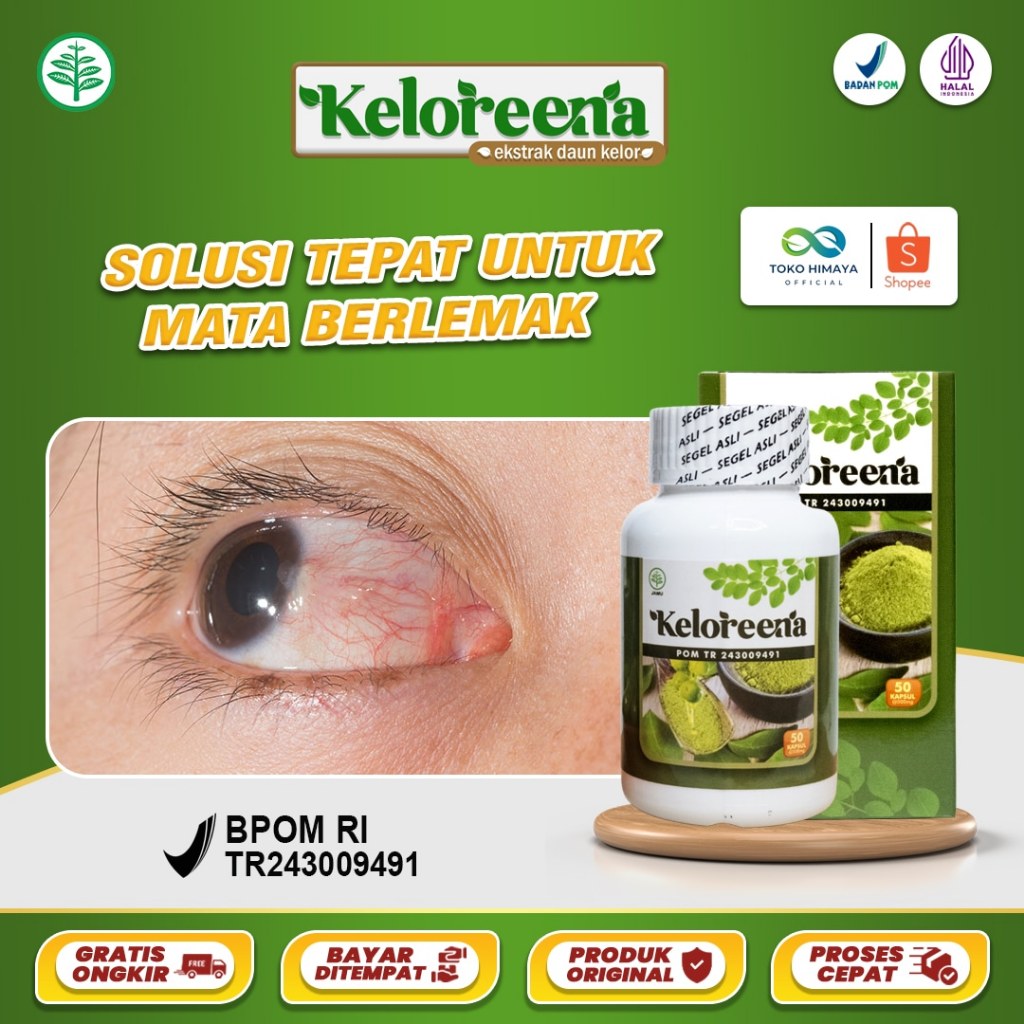Jual Obat Herbal Mata Berlemak, Berlendir, Berselaput, Berkabur, Mata Pterygium, Lamad Mata ...
