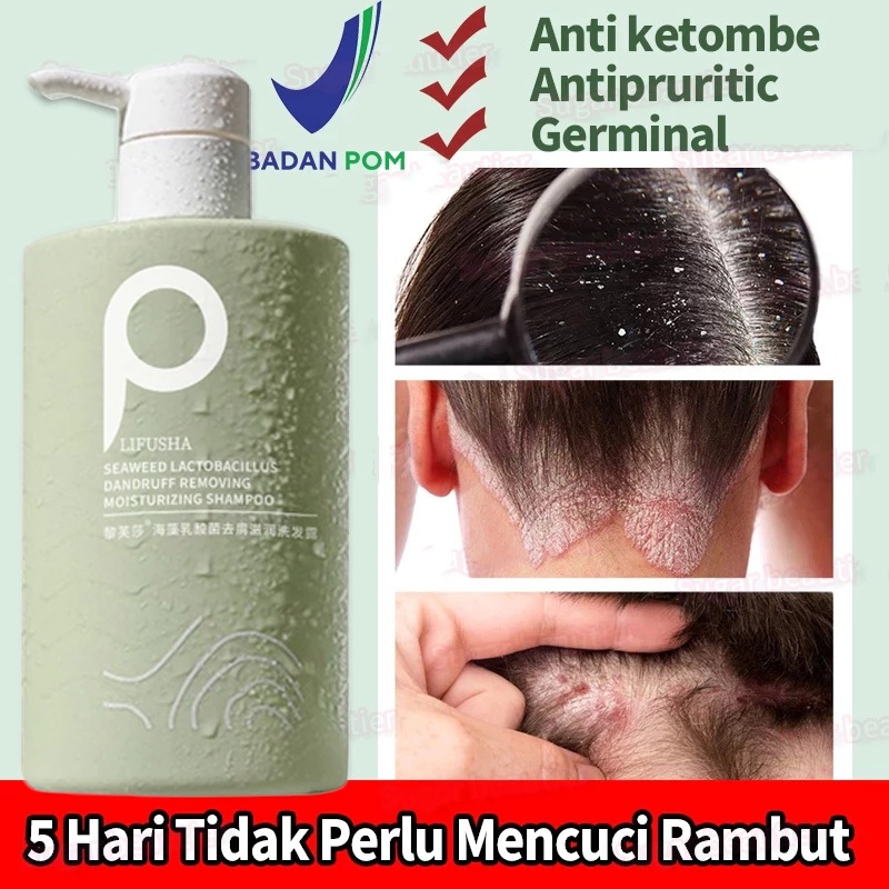 Jual Obat Ketombe Sampo 500ml Garam Laut Buat Ketombe Penghilang Anti Gatal Pengobatan Tungau ...