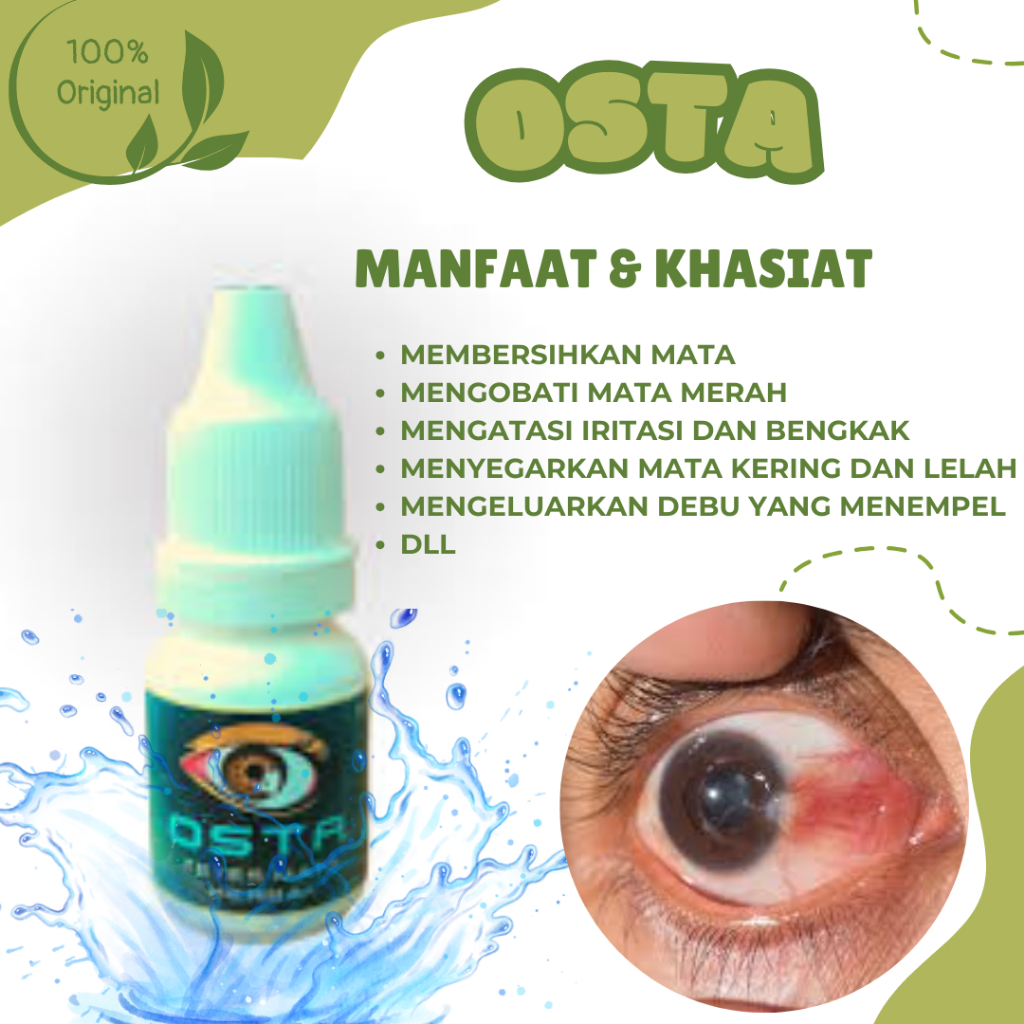 Jual Mata Terasa Terbakar, Gatal, Kelopak Mata Membengkak Dan Berat ...