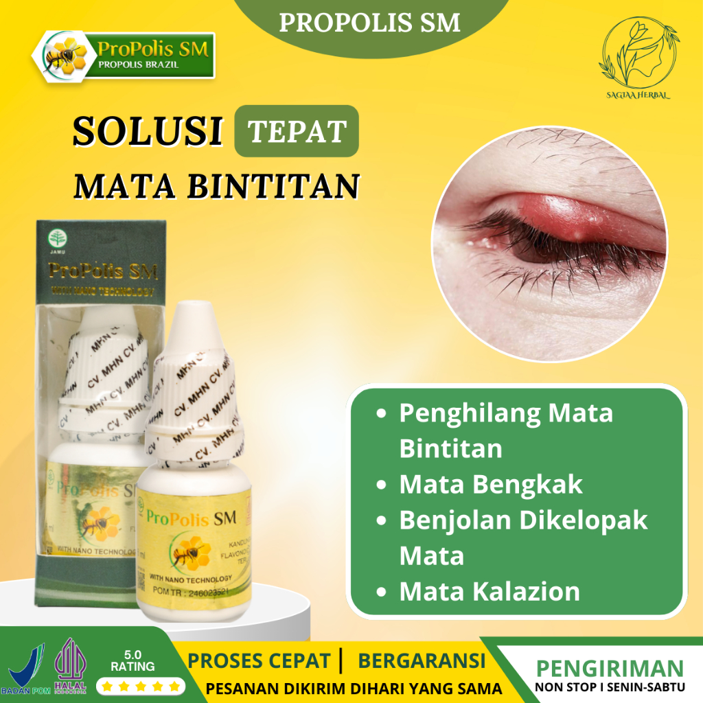 Jual Obat Penghilang Mata Bintitan Mata Bengkak Benjolan Dikelopak Mata ...