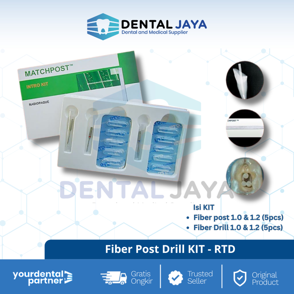 Jual RTD Dental Fiber Post Intro Kit Set Pasak Fiber Matchpost | Shopee ...