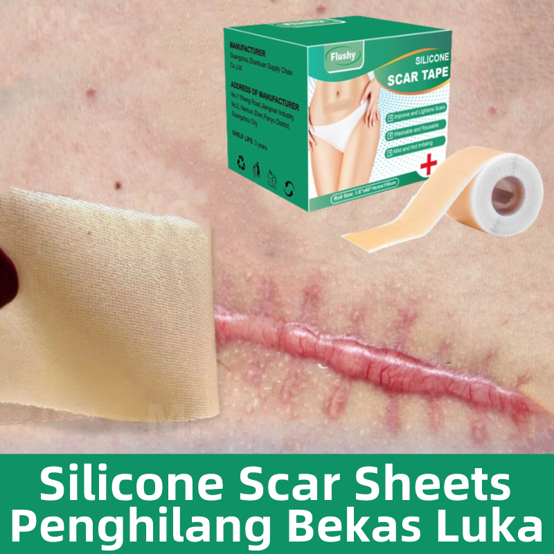 Jual Silicone scar sheet Keloid plester Penghilang bekas luka ...