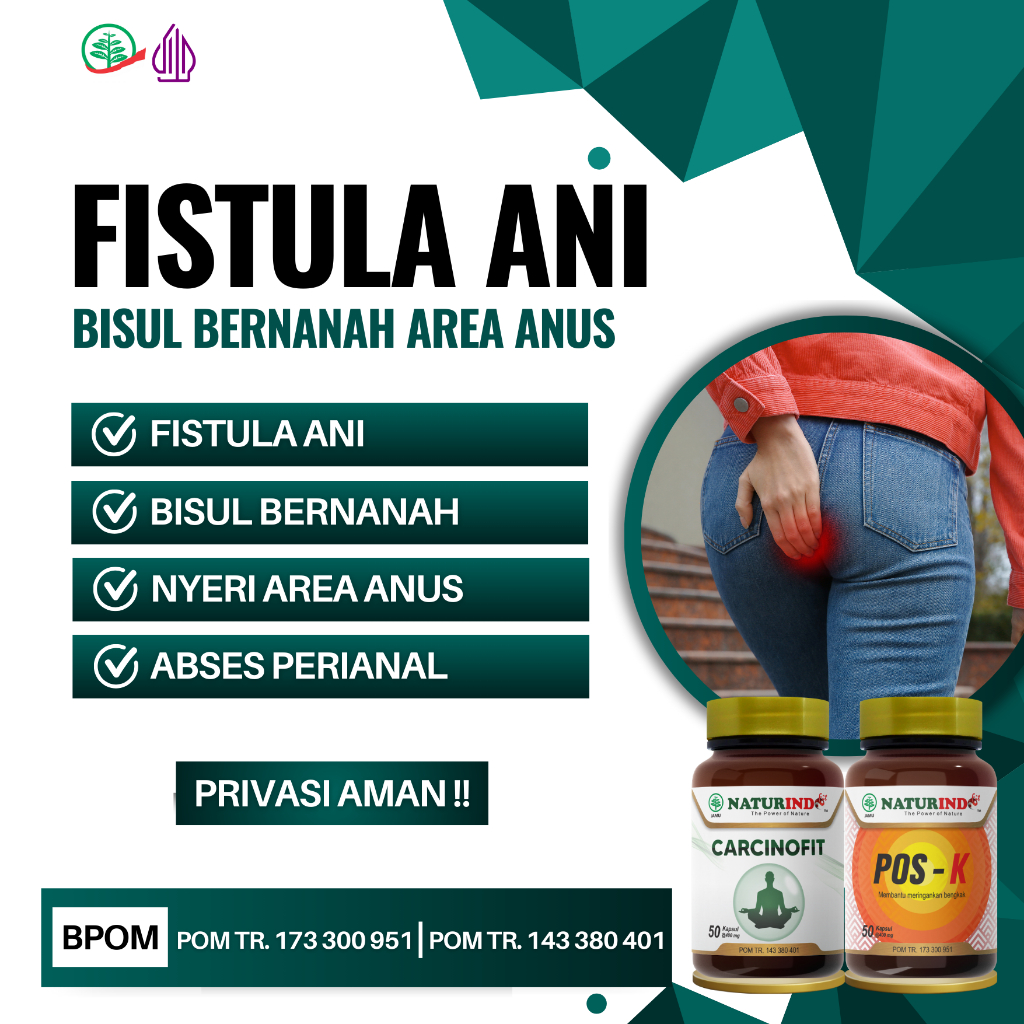 Jual Obat Fistula Ani Bisul di Pantat Bernanah Vistula Ani Ampuh Abses ...