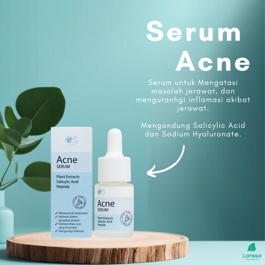 Jual Larissa Jamal - Acne Serum - Serum Wajah Untuk Mengatasi Jerawat ...