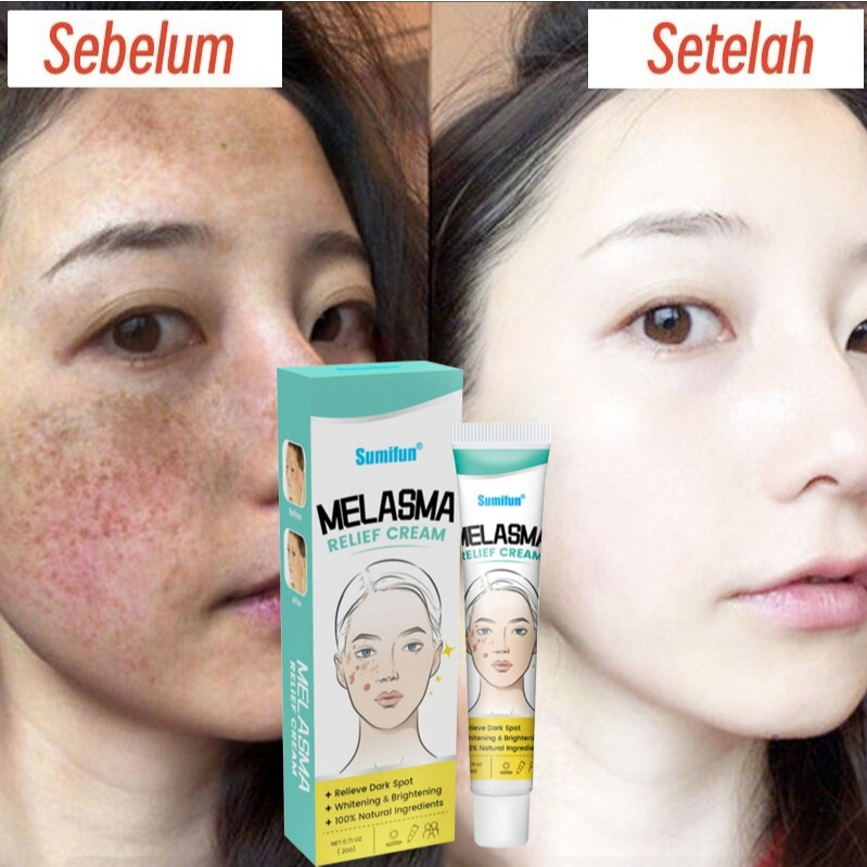 Jual penghilang flek hitam 100%Effective Cream Whitening Freckle Cream Bintik Melasma ...