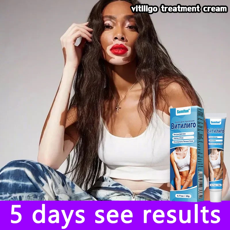 Jual musuh panu, membantu pertumbuhan melanin, krim penyamar noda, obat ...