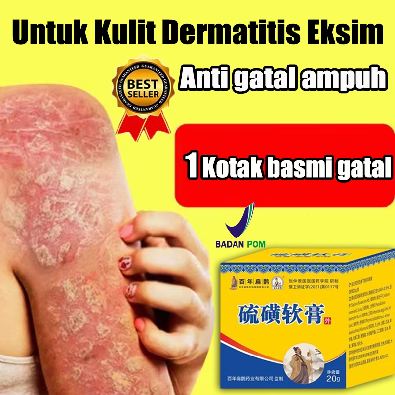 Jual Salep Gatal Paling Ampuh obat gatal selangkangan salep eksim ...
