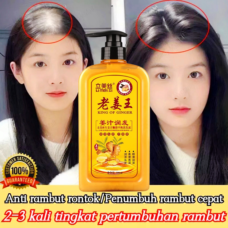 Jual Shampo Penumbuh Rambut Cepat Anti rambut rontok Botak ginger shampoo 500ml Botak Rontok ...
