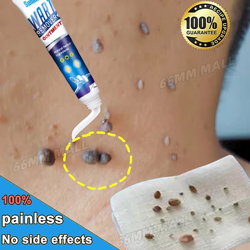 Jual [100% Original]Sumifun penghilang kutil dan tahi lalat penghilang ...