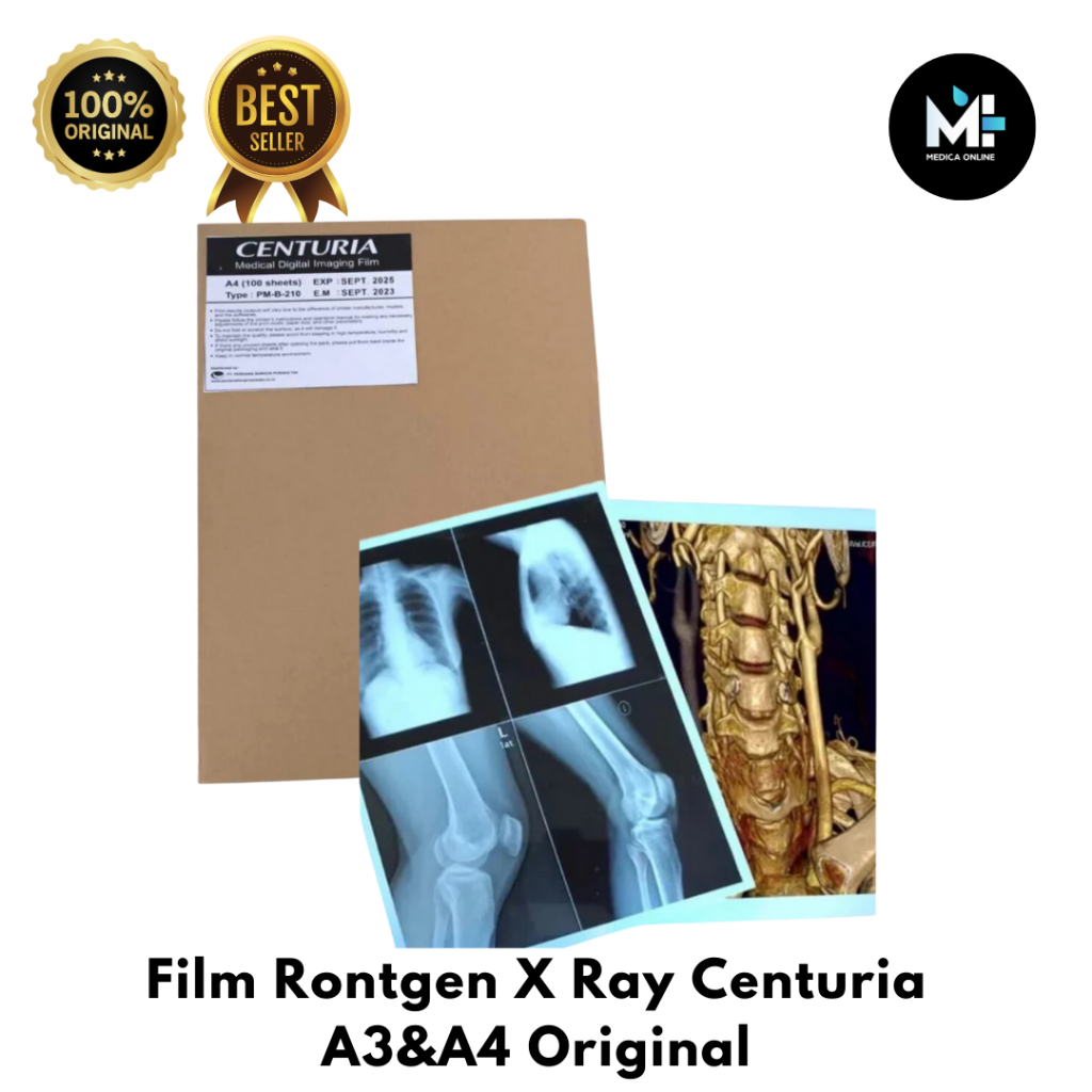 Jual Film Rontgen X Ray Centuria A3&A4 Original | Shopee Indonesia