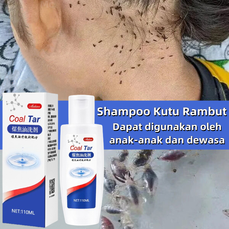 Jual Shampoo kutu rambut Shampo pembasmi kutu anak anak Penghilang kutu ...