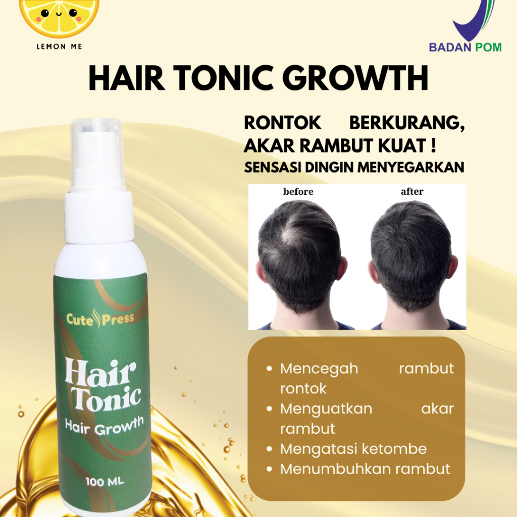Jual PROMO HAIR GROWTH TONIC SPRAY / VEGAN HAIR TONIC / PENUMBUH RAMBUT ...