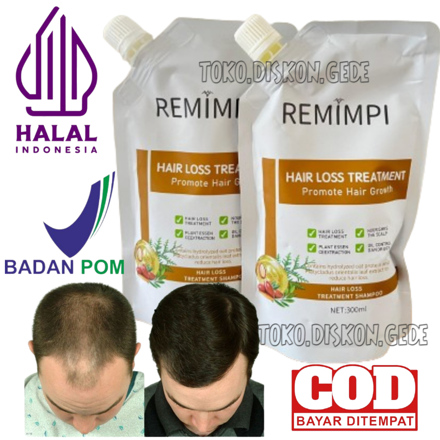 Jual Remimpi hair loss treatment Anti Hair Fall Shampo Kebotakan Rambut ...