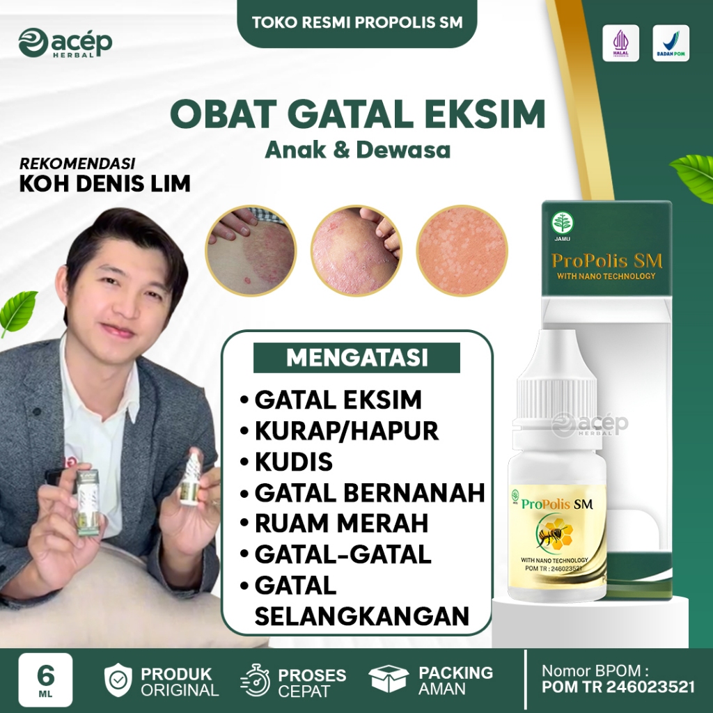 Jual Obat Eksim Kering Exim Basah Penyakit Kulit Gatal Parah Alergi ...