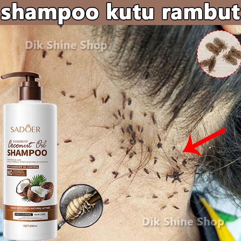 Jual Shampoo kutu rambut anak dan dewasa anti kutu shampoo penghilang ...