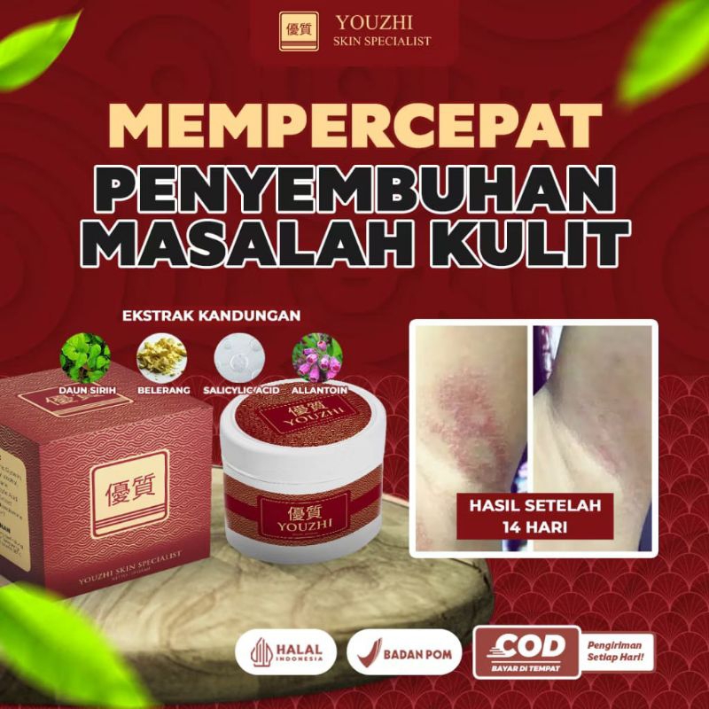Jual Salep Youzhi Original Membantu Mengatasi Gatal Eksim, Alergi Kulit ...
