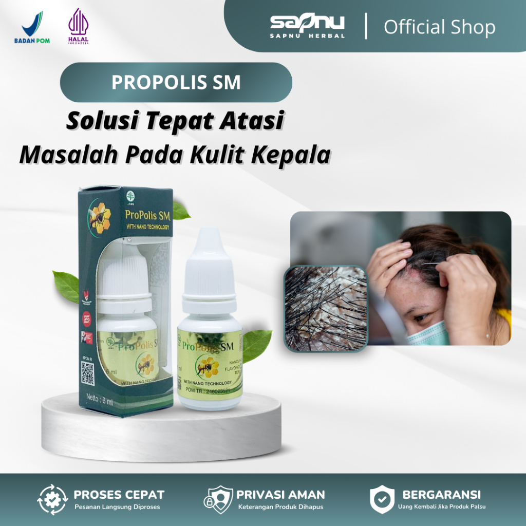 Jual Obat Koreng di Kepala, Borok di Kulit Kepala, Luka Koreng di Kulit ...