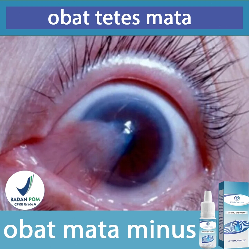 Jual Obat mata minus obat mata katarak obat tetes mata pembersih mata ...