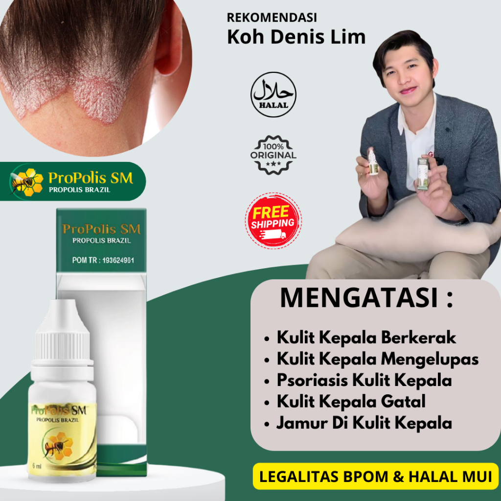 Jual Obat Salep/Oles Psoriasis Kulit Kepala Kering Berkerak Bersisik Jamur Bersisik Ketombe ...