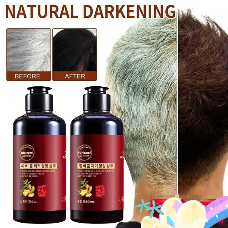 Jual YURIZUMI~NAN MEI Shampoo Uban Menjadi Hitam dan Penyubur Rambut ...