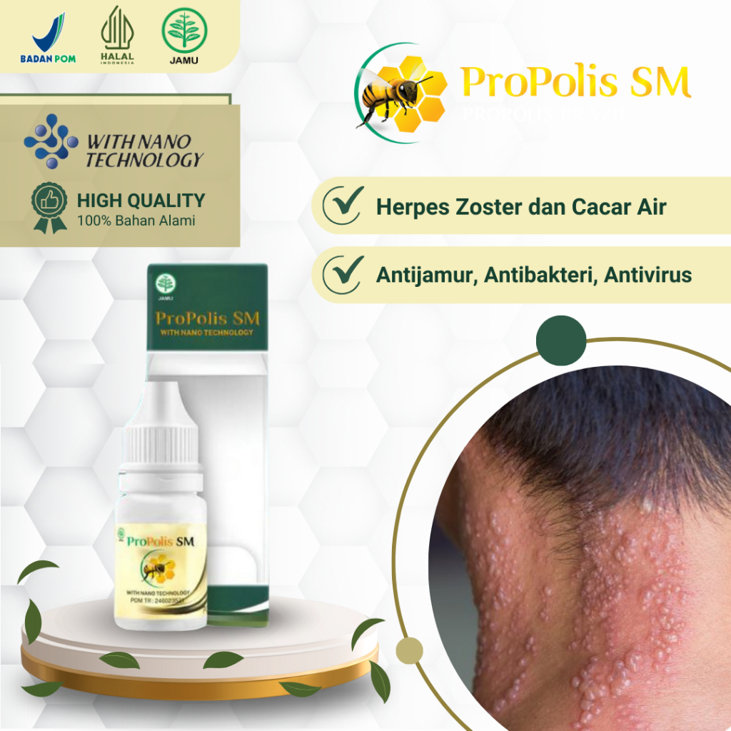 Jual Propolis SM Brazil - Obat Herpes Zoster, Obat Herpes Genital, Obat ...
