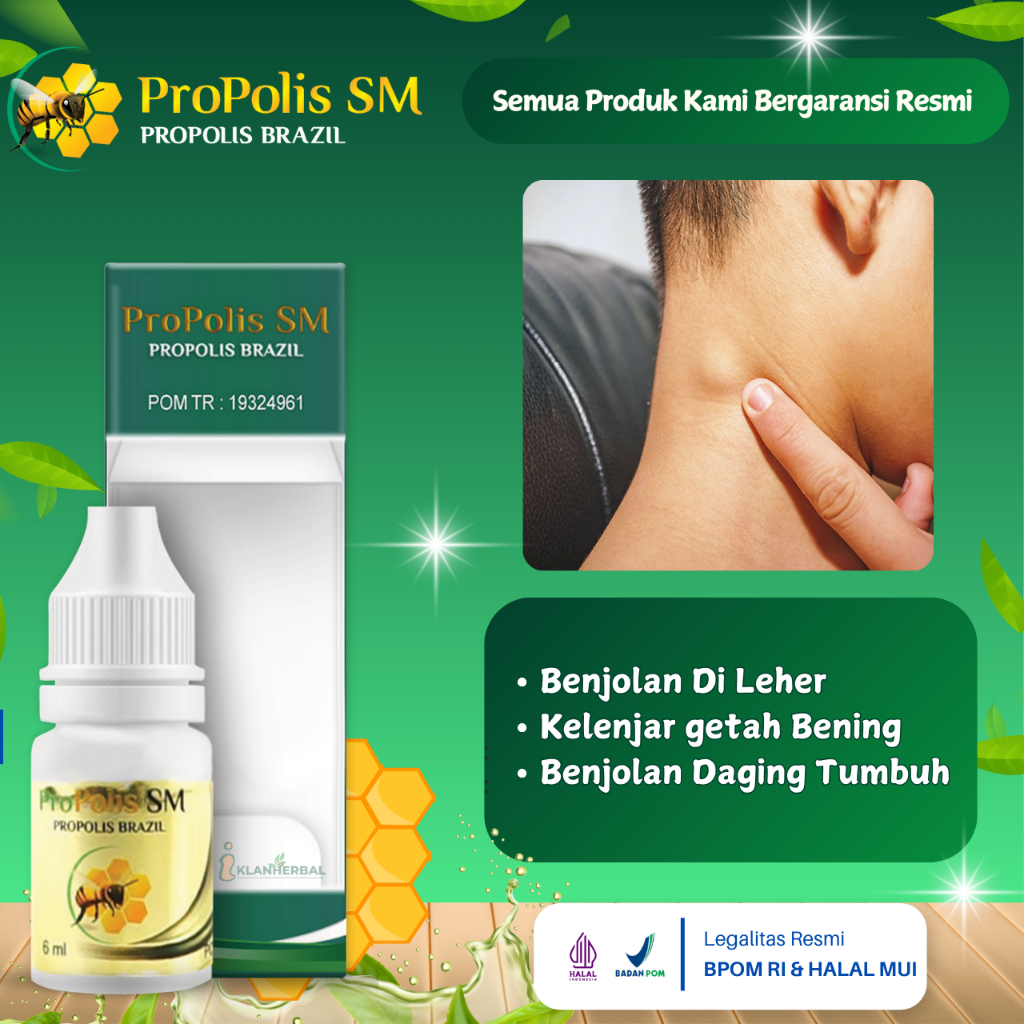 Jual Propolis SM Obat Benjolan Di Leher Kelenjar Getah Bening Lipoma ...