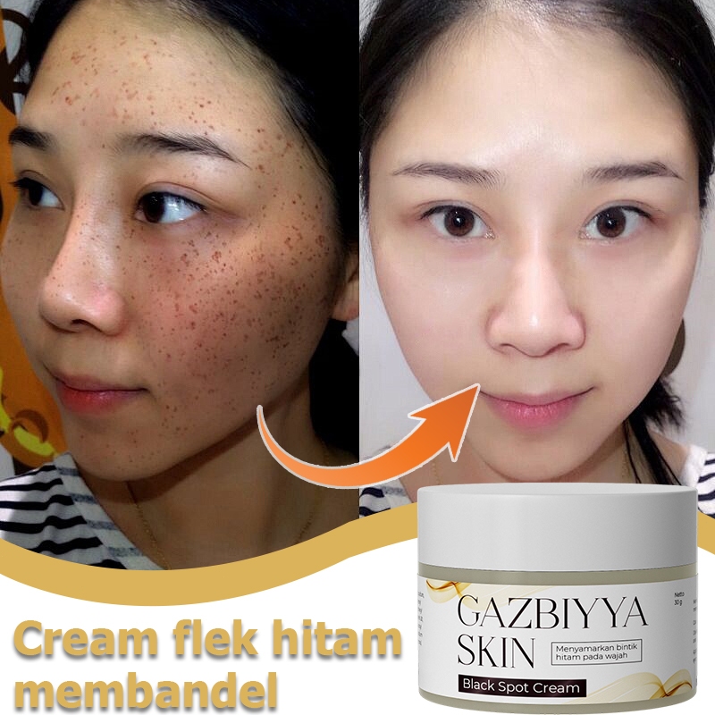 Jual Cream flek hitam membandel Cream penghilang flek hitam Krim penghilang flek hitam ...
