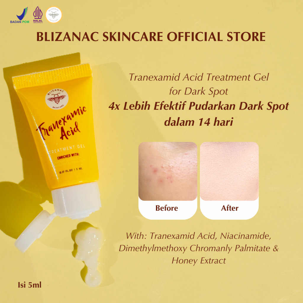 Jual BLIZANAC SKINCARE Tranexamic Acid Gel Treatment untuk Flek Hitam ...