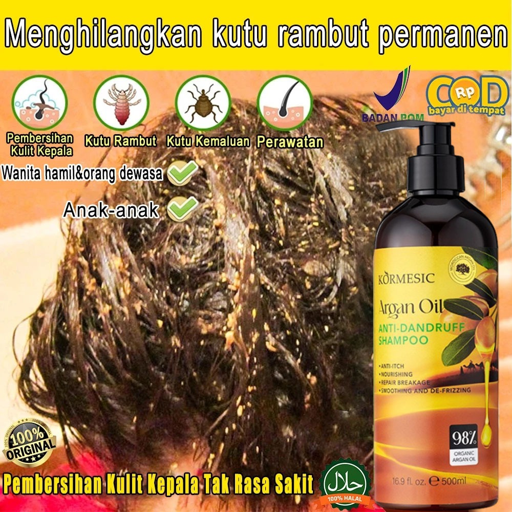Jual Sampo Kutu Rambut Anak2&Dewasa, Sampo Penghilang Kutu Paling Ampuh ...