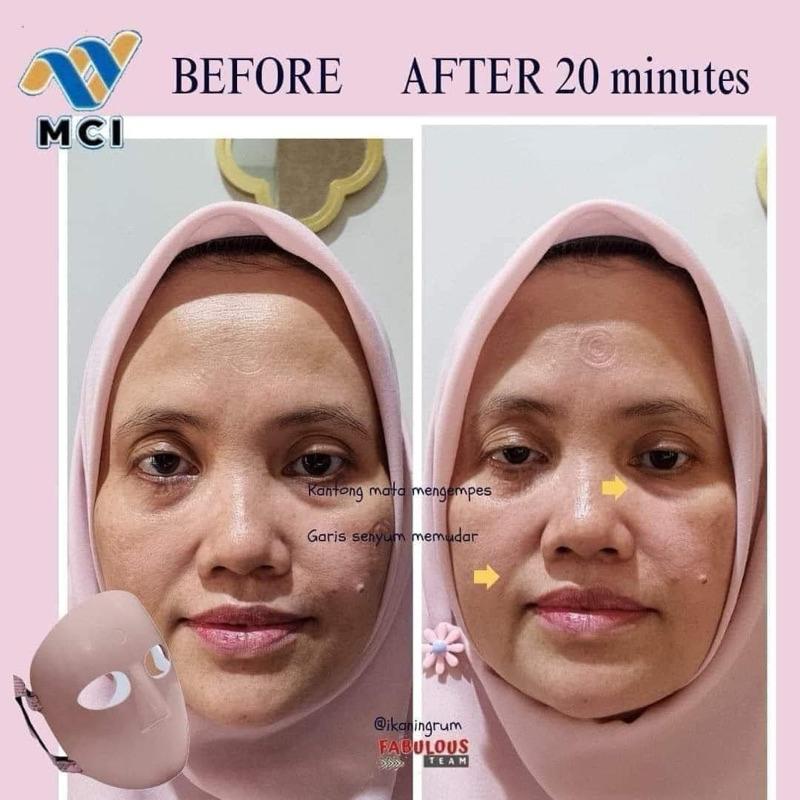 Jual LUMIFACE MASKER MCI PROMO | MASKER VIRAL KECANTIKAN | MASKER DARI KOREA | TEKHNOLOGI ...