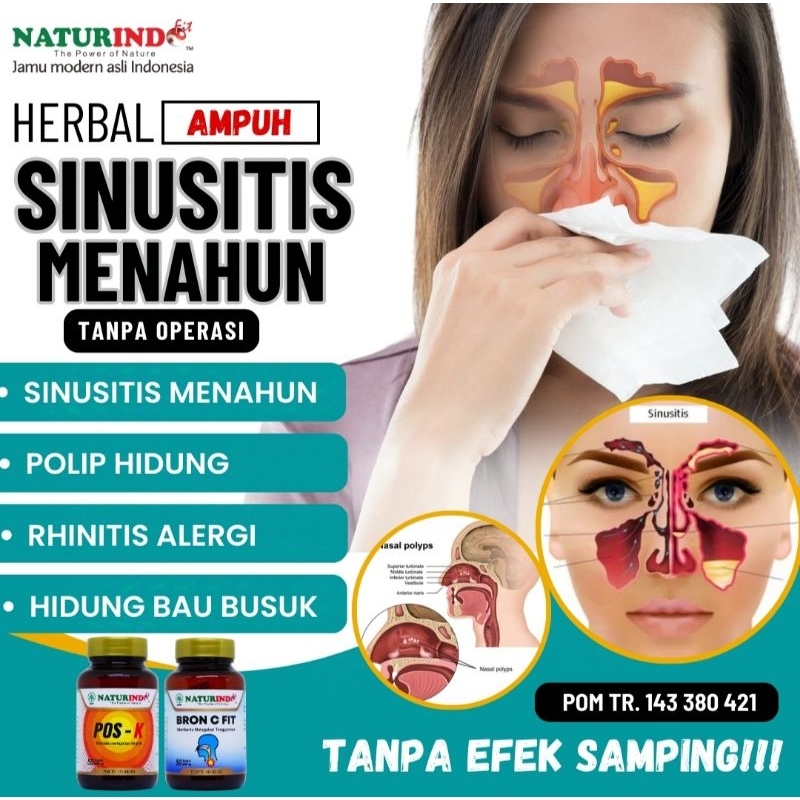 Jual Obat Sinusitis Polip Hidung Rhinitis Alergi Sinus Hidung Bau Busuk ...