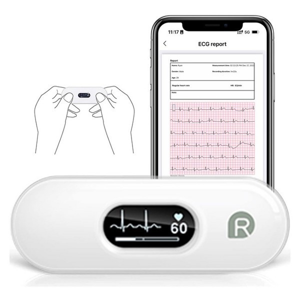 Jual Checkme DuoEK S Portable ECG Monitor with OLED Screen Alat EKG ...