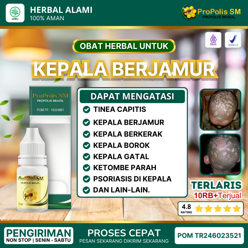 Jual Obat Jamur Kulit Kepala, Obat Borok di Kepala, Obat Kulit Kepala Gatal, Obat Tinea Capitis ...
