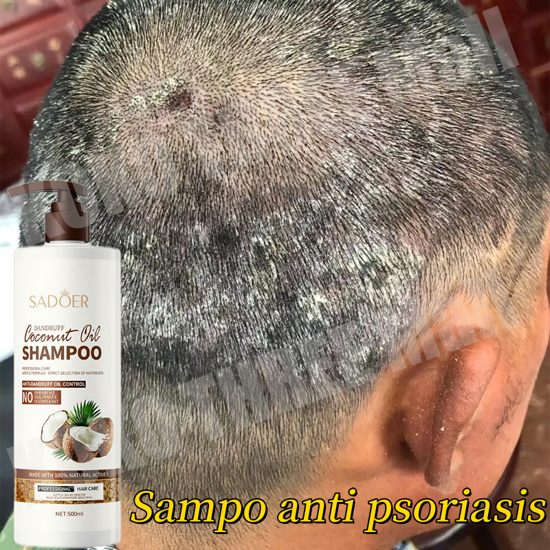 Jual shampo anti ketombe Sampo Anti Ketombe Shampo Kelapa Pelembab anti gatal Coconut shampo ...