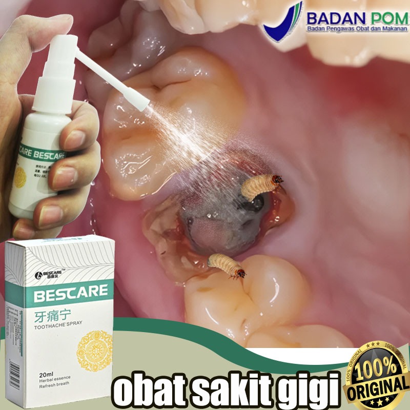 Jual Obat sakit gigi Obat sakit gigi anak Obat sakit gigi berlubang ...