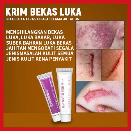 Jual Medical ointments remove scars without scars Surgical wounds burns ...