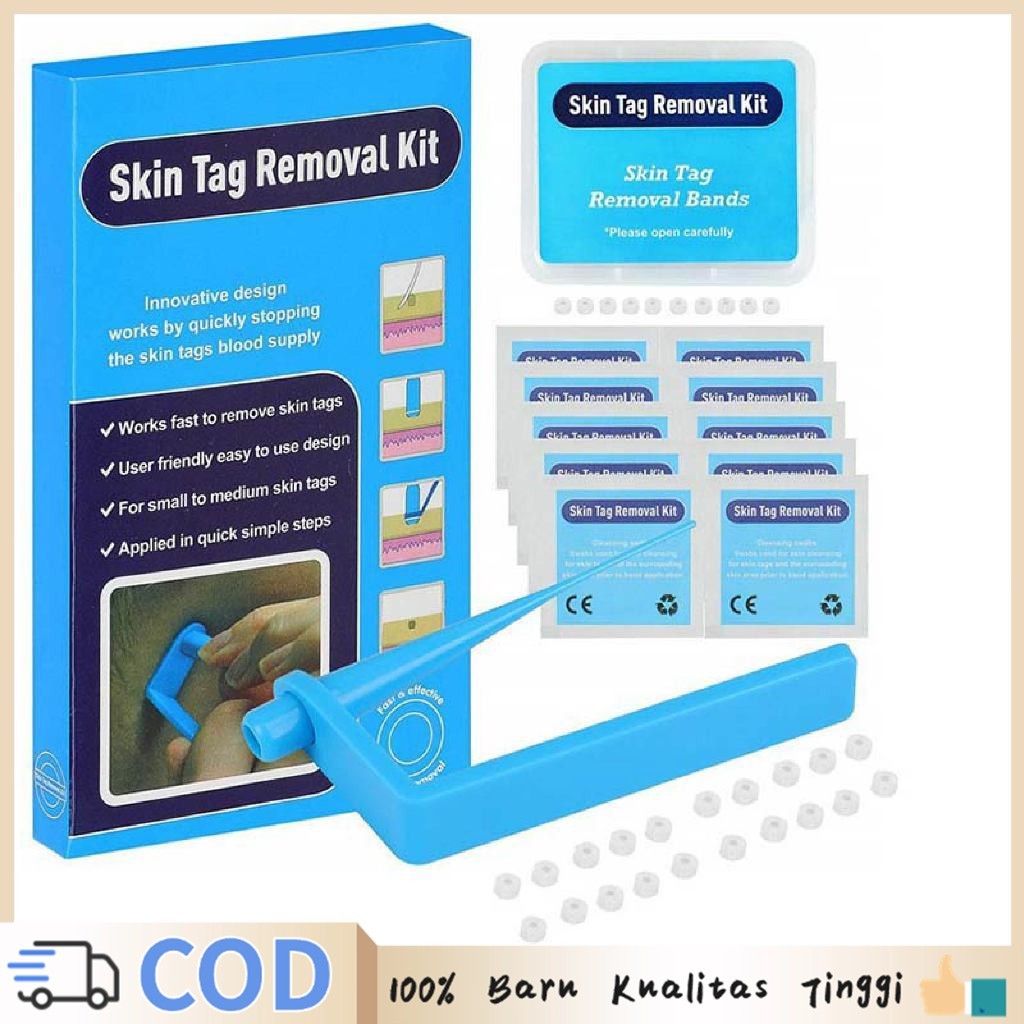 Jual Obat Kutil Kit Penghilang Tag Kulit Skin Tag Removal Kit High ...