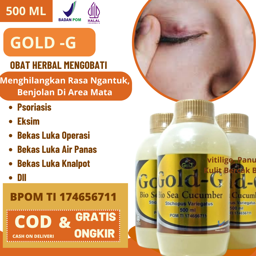 Jual GOLD-G // Obat Untuk Menghilangkan Rasa Ngantuk, Benjolan Di Area ...