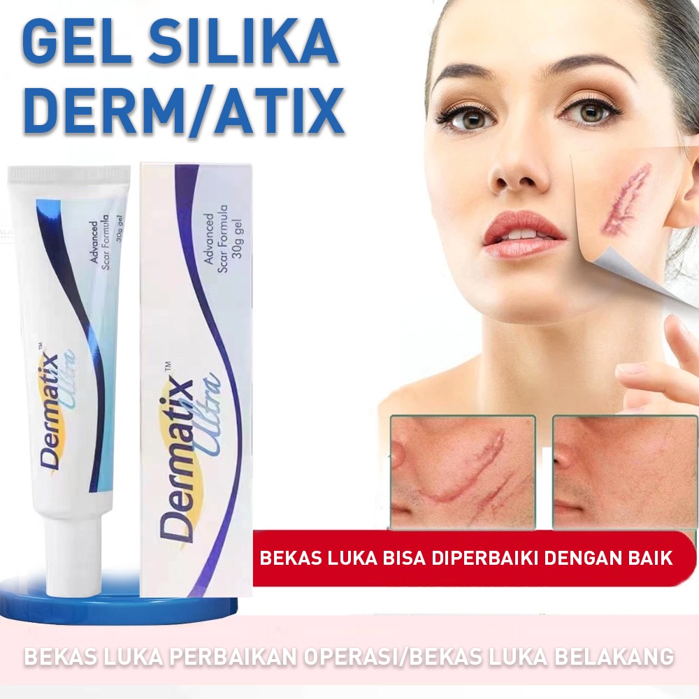 Jual Dermatix Ultra Gel 15g Cream Penghilang Bekas Luka/Penghilang ...