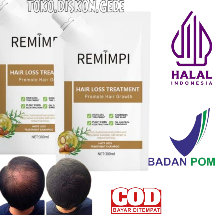 Jual Remimpi Shampo hair loss treatment Penumbuh Rambut Anti Hair Fall ...