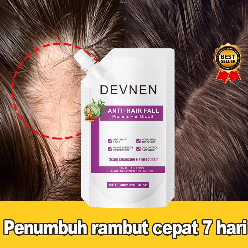 Jual Sampo Penumbuh Rambut Cepat 300gr Rambut Rontok Serum Rambut ...