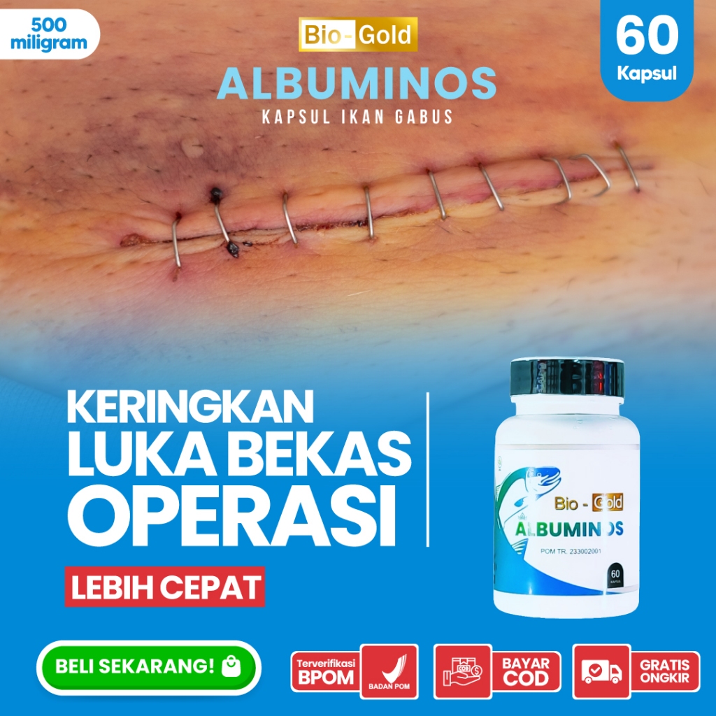 Jual Albuminos Asli Kapsul Ekstrak Ikan Gabus Albumin Kutuk Membantu ...