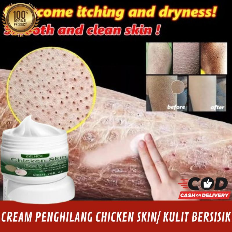 Jual Chicken Skin Cream penghalus pelembut kulit kering bersisik ...