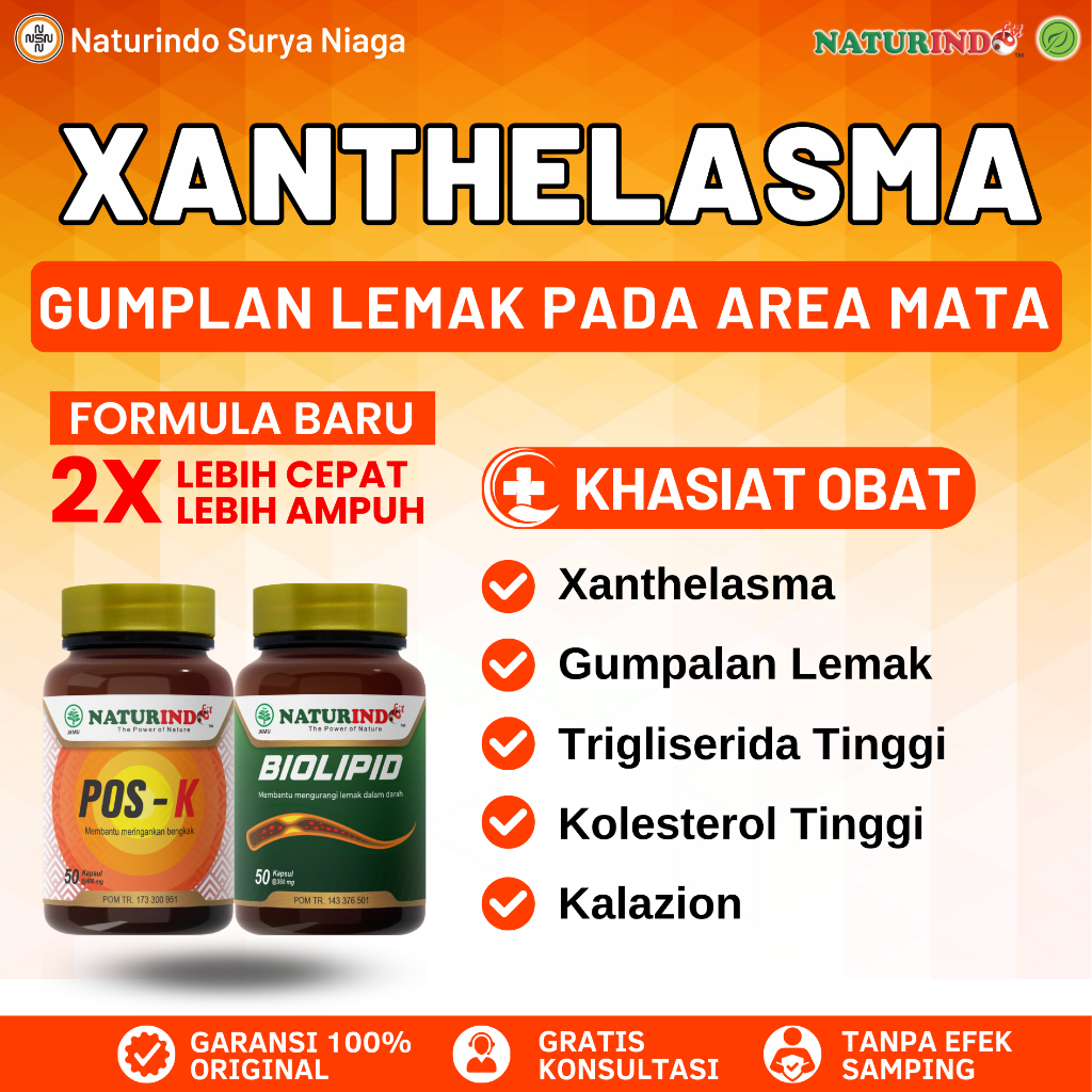 Jual Obat Xanthelasma Gumpalan Lemak Plak Kuning di Mata Bintitan ...