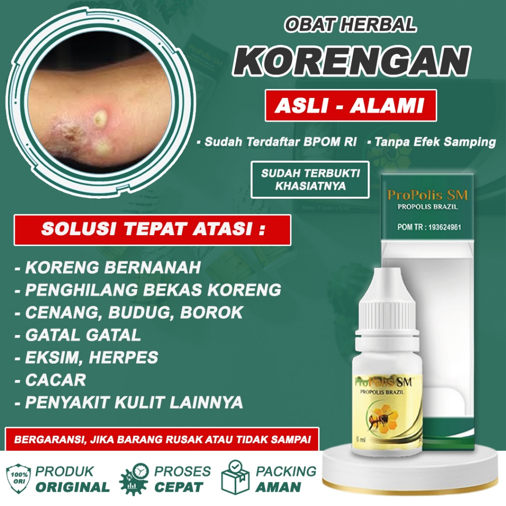 Jual Obat Korengan Penghilang Bekas Luka Hitam Koreng Cenang Borok ...