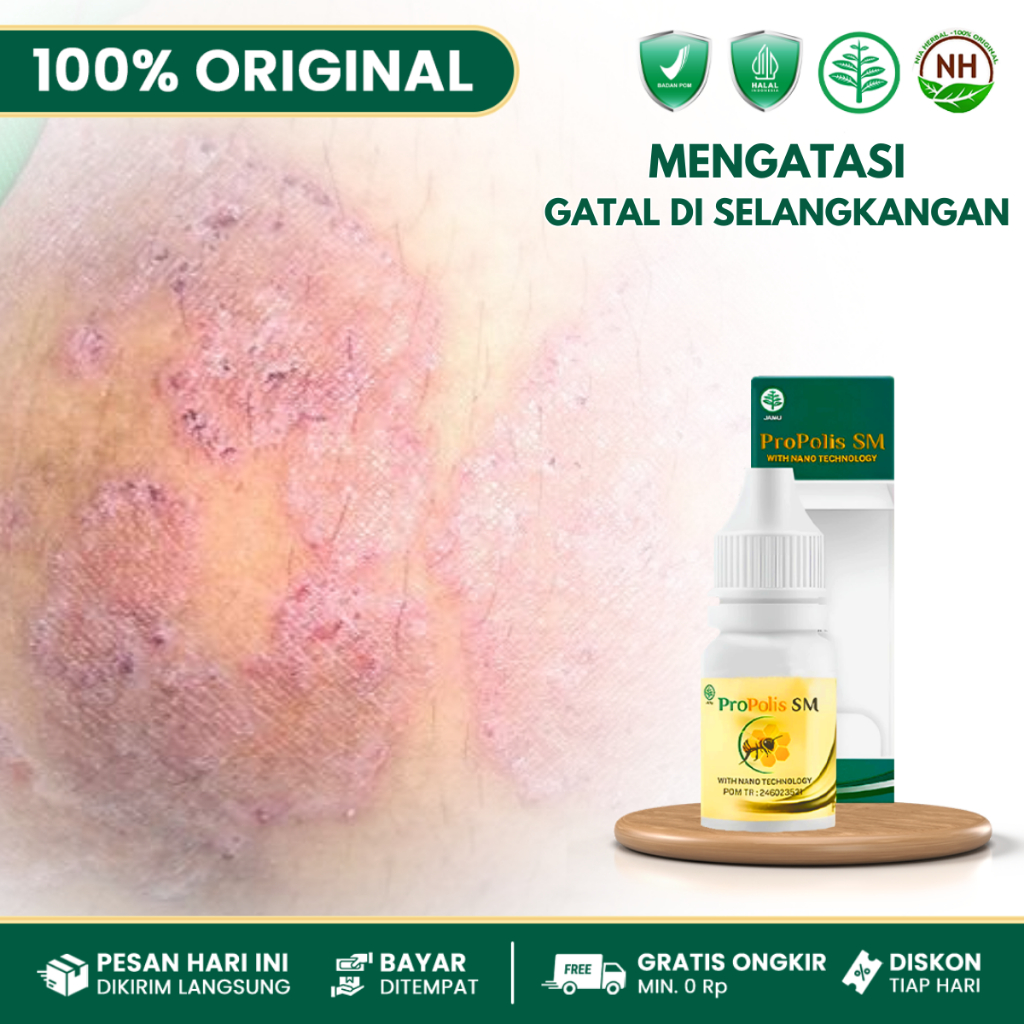 Jual Obat Gatal Gatal Di Selangkangan Akibat Infeksi Jamur - Herpes ...