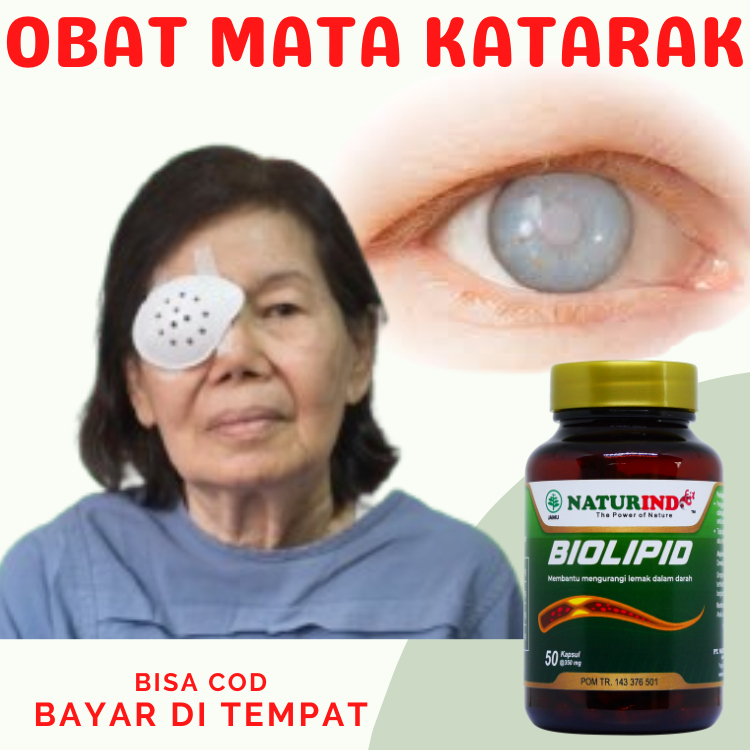 Jual Obat Katarak Mata Katarak Mata Glukoma Herbal Kolesterol Tinggi ...