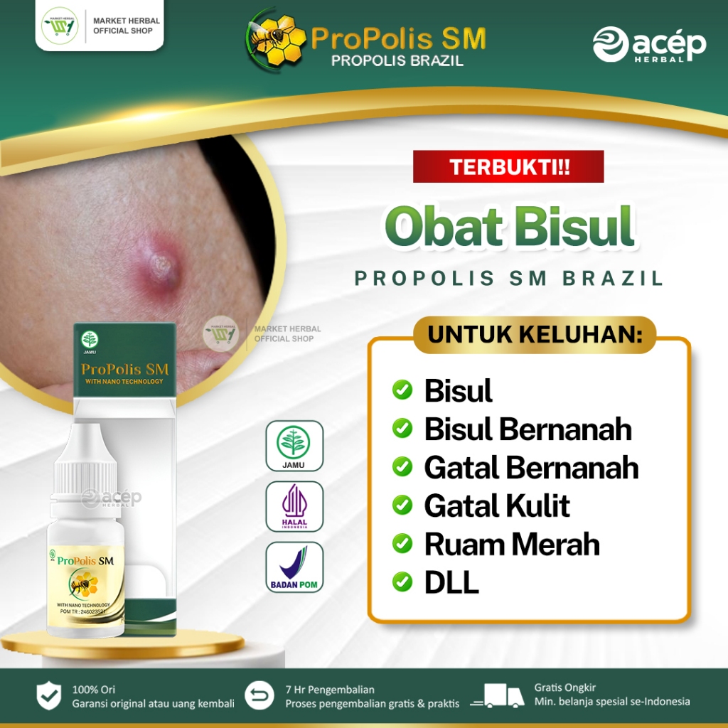 Jual Obat Bisul, Bisul Di Pantat Bayi Anak Dan Dewasa Bisulan Bisul ...